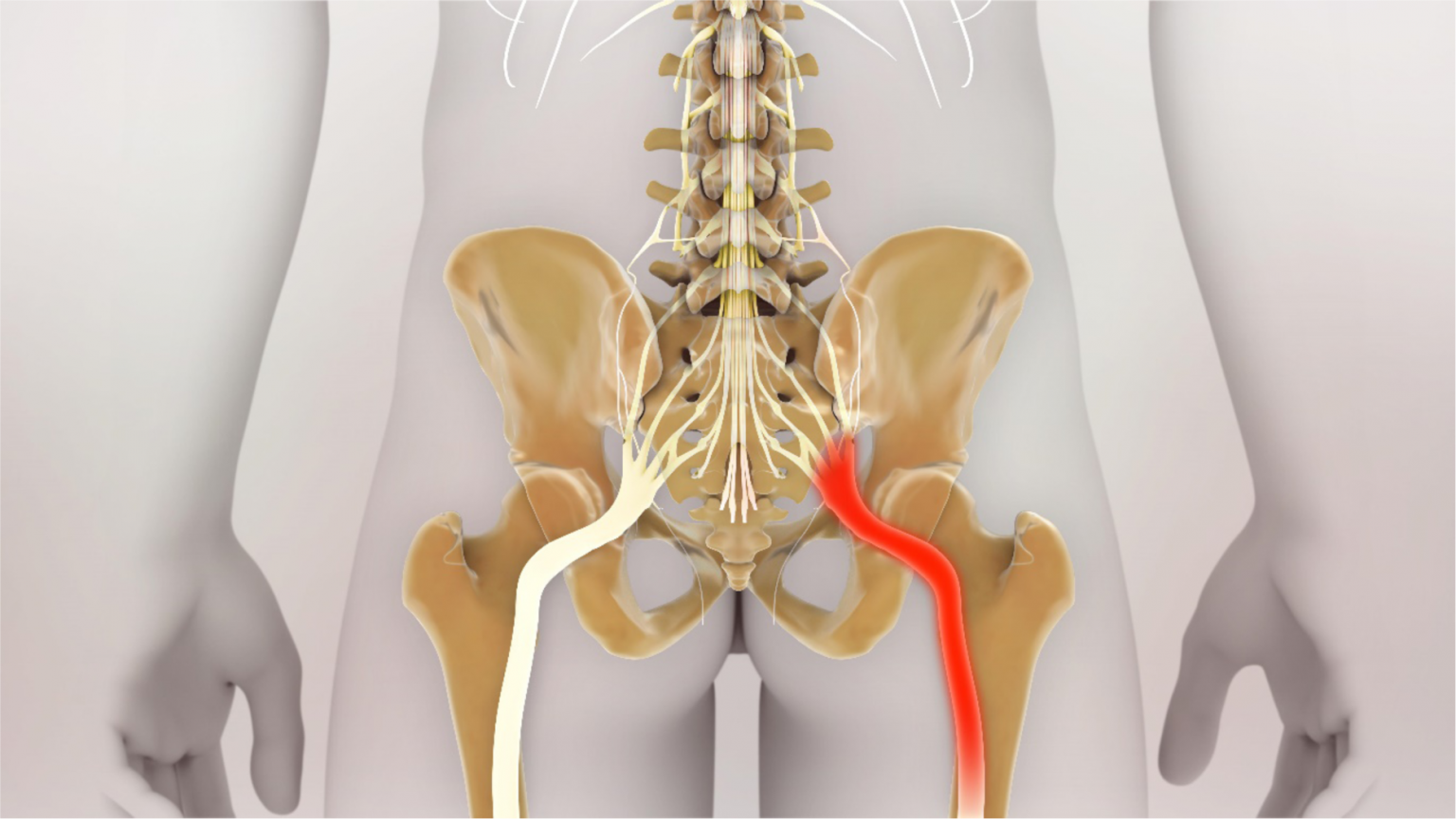 Trapped Nerves Explained | Buxton & Bakewell Osteopathy Clinic